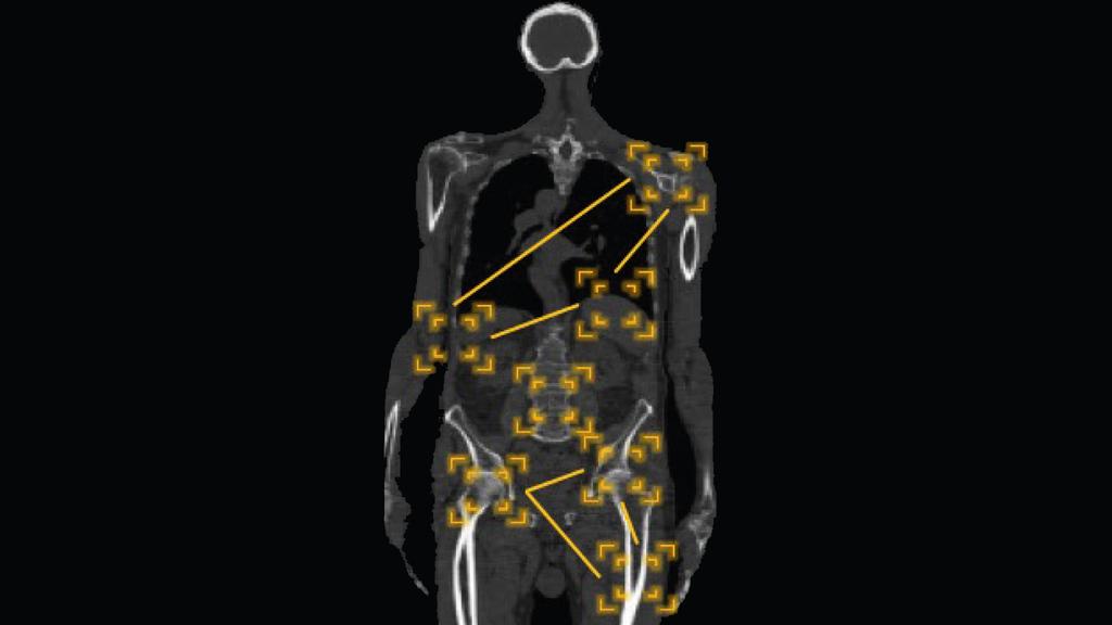 Patient pathways for guided CT imaging - Siemens Healthineers Brasil