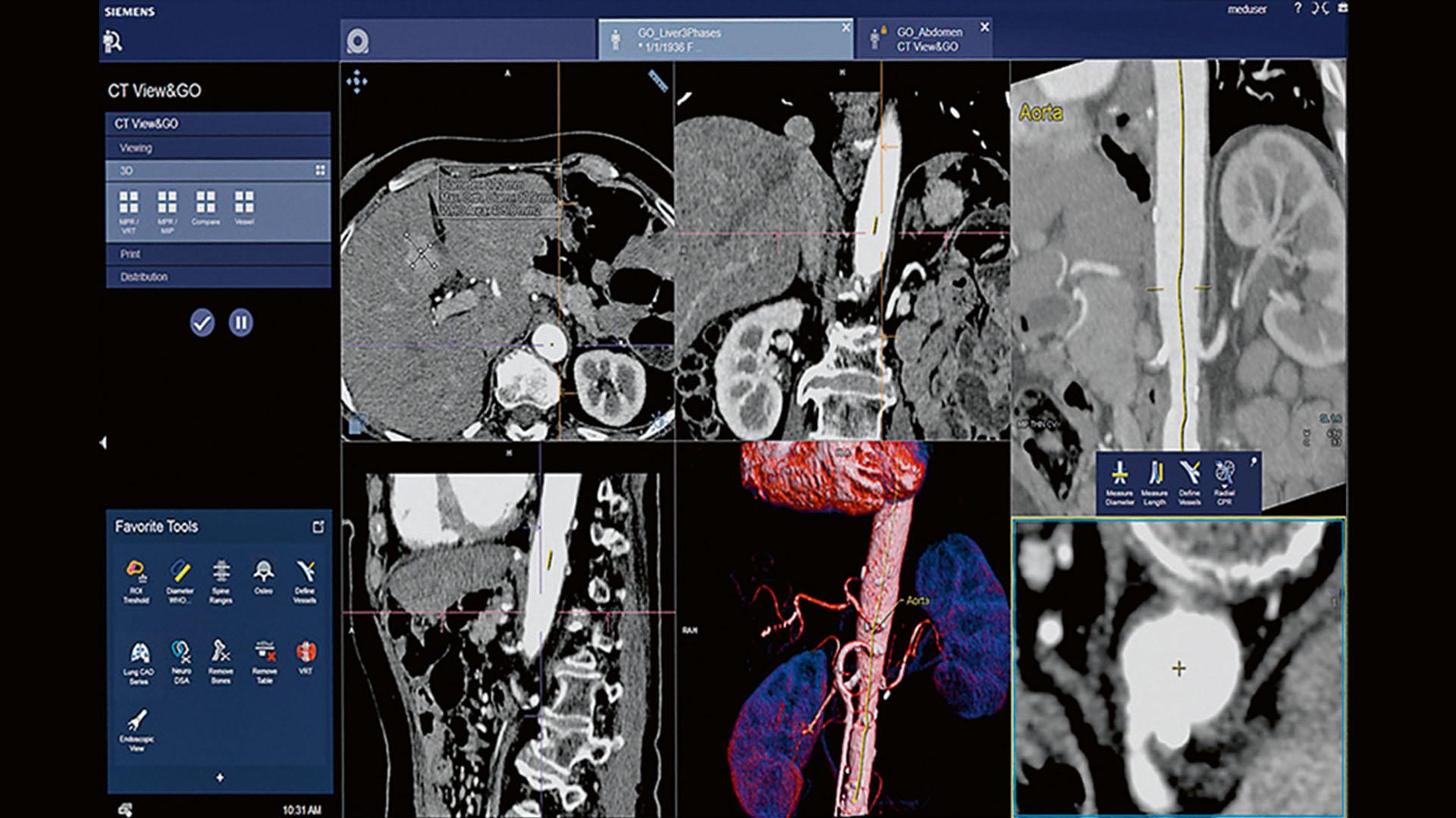 Patient pathways for guided CT imaging - Siemens Healthineers Brasil