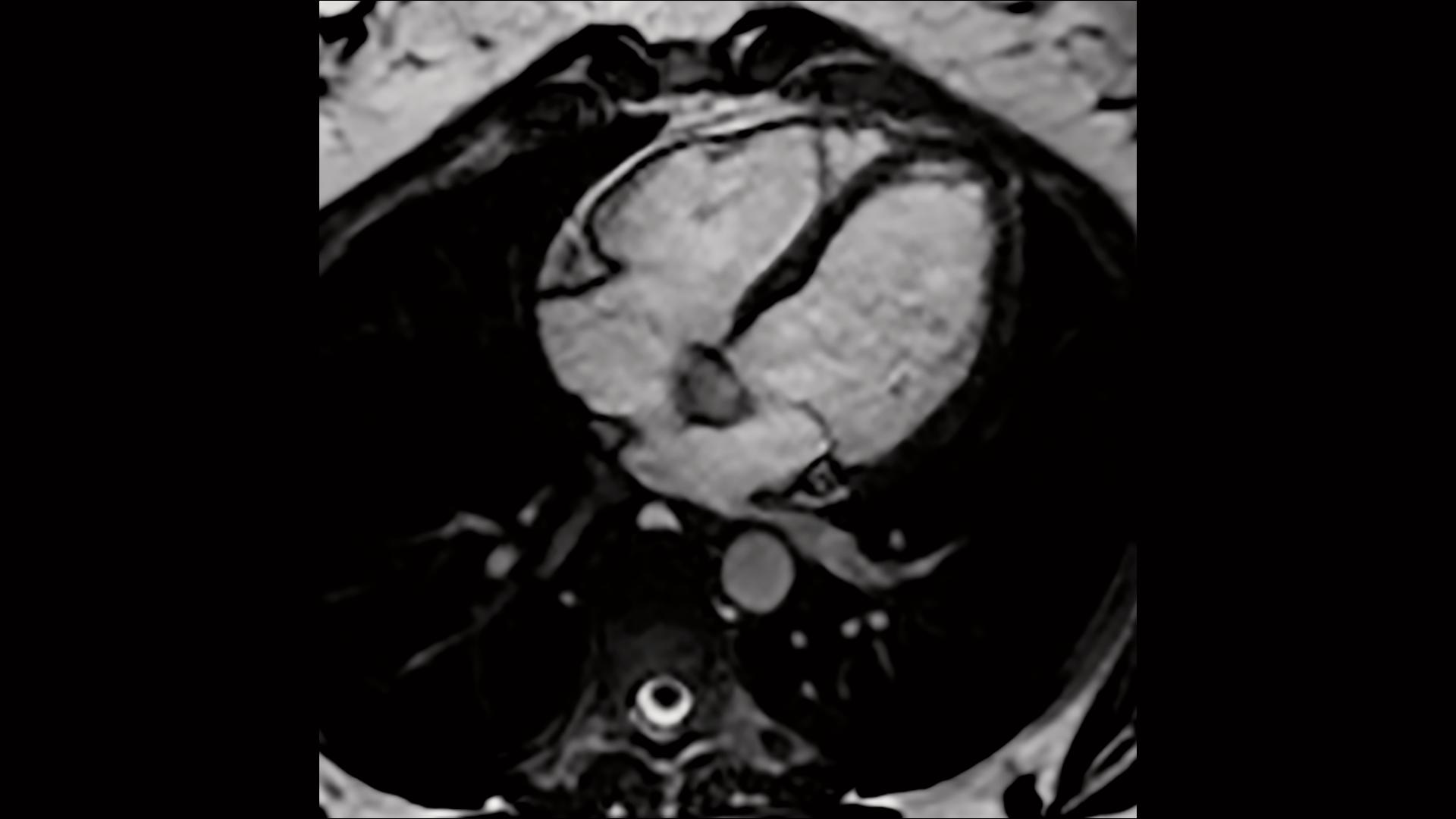 MAGNETOM Sola 1.5T MRI system with BioMatrix