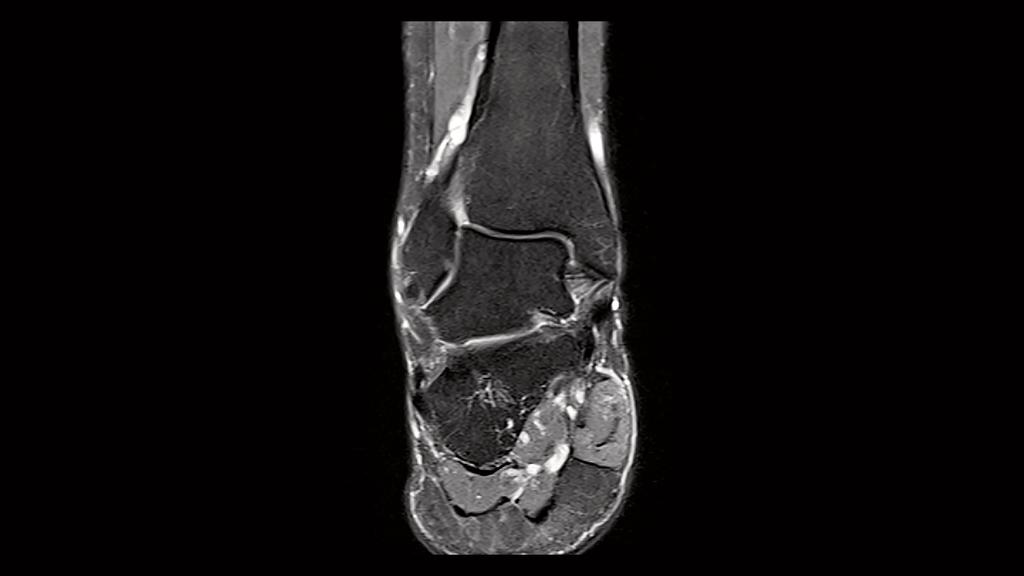 MAGNETOM Sola 1.5T MRI system with BioMatrix