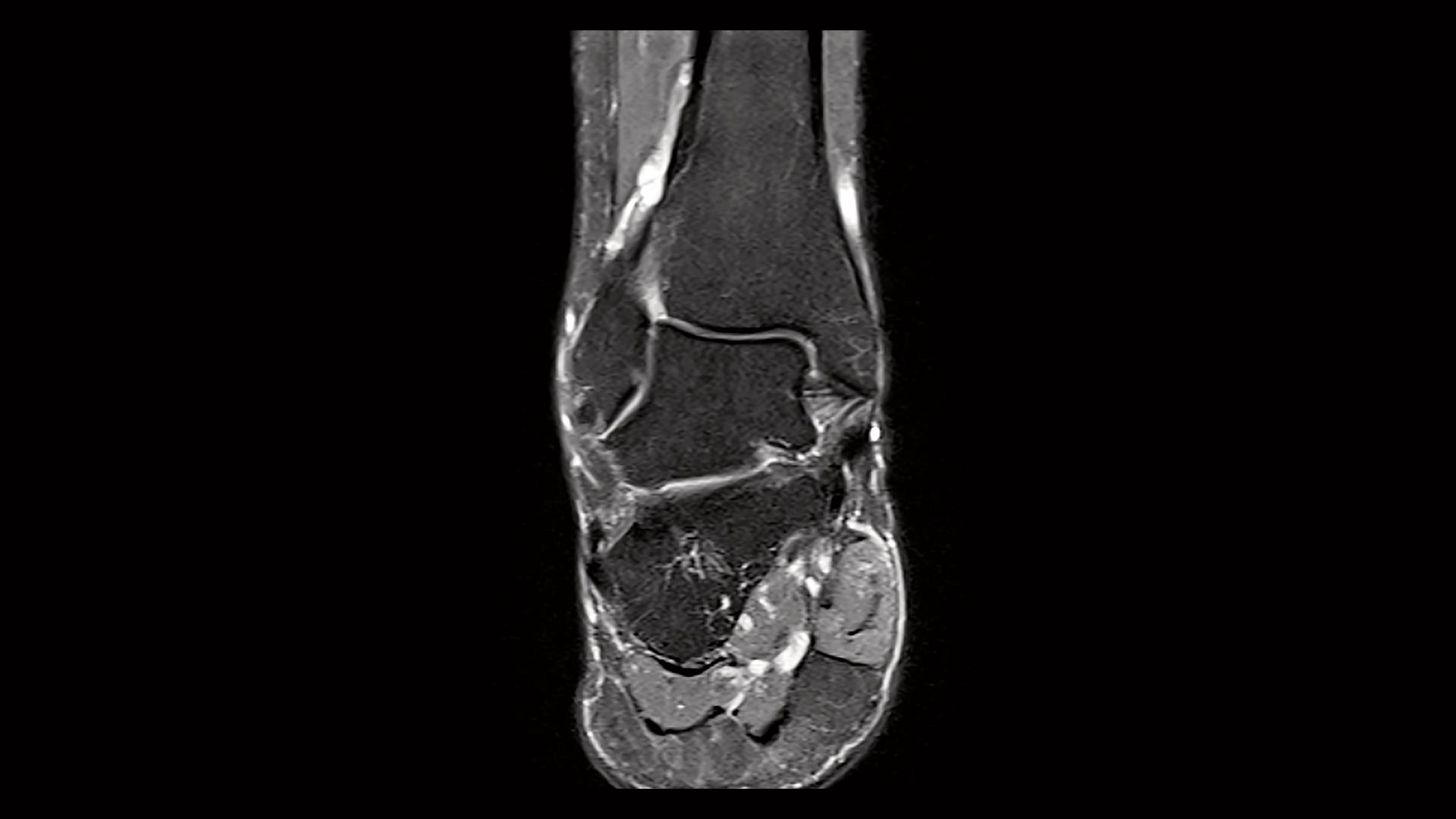 MAGNETOM Sola 1.5T MRI system with BioMatrix - Siemens Healthineers
