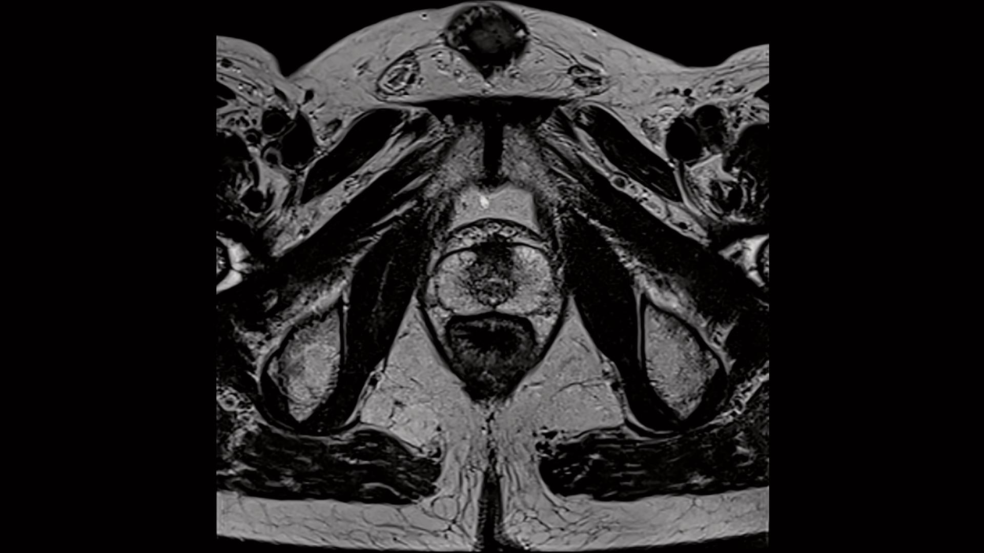 MAGNETOM Sola 1.5T MRI system with BioMatrix - Siemens Healthineers