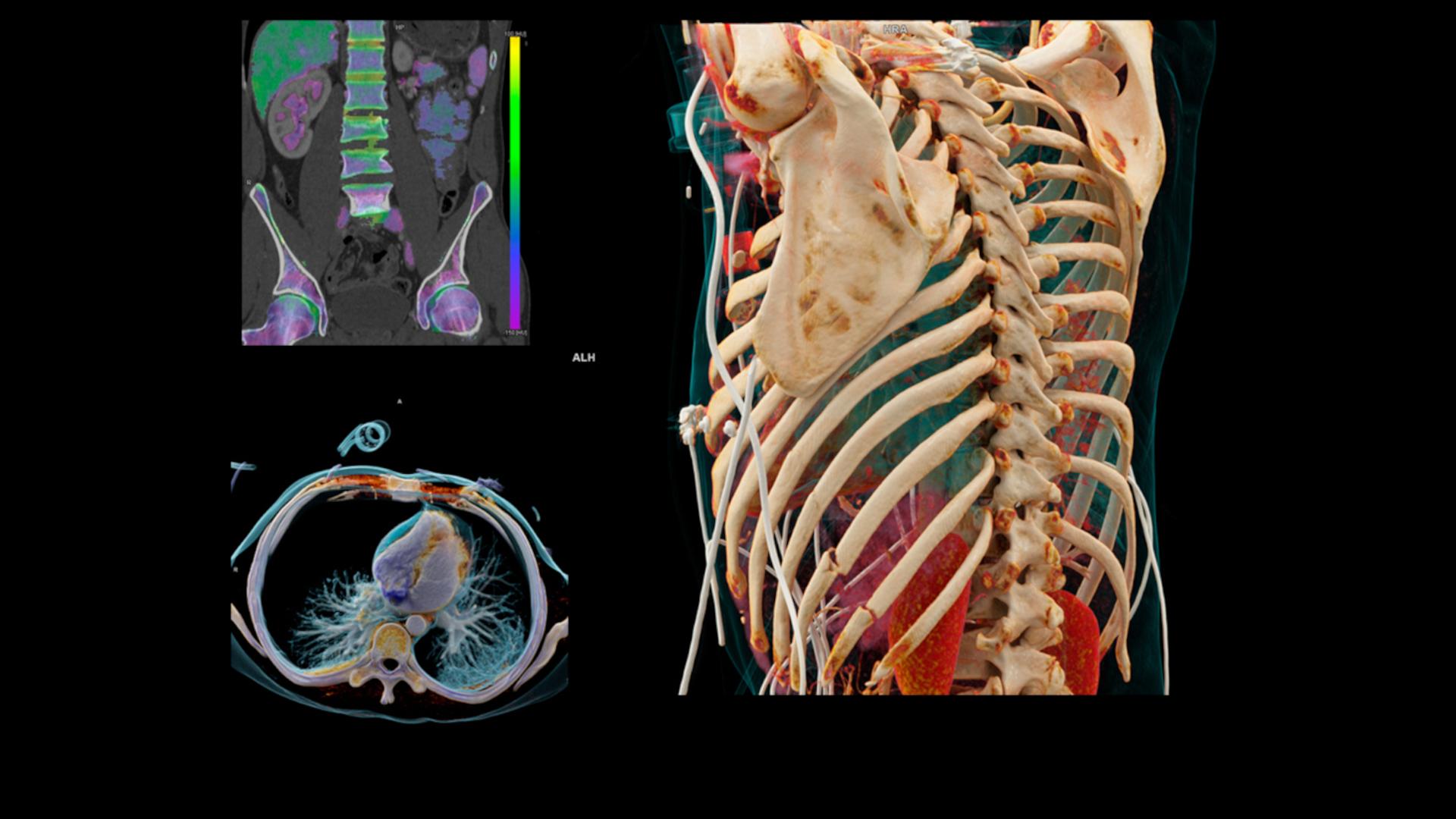 Dual Source CT Siemens Healthineers Italia