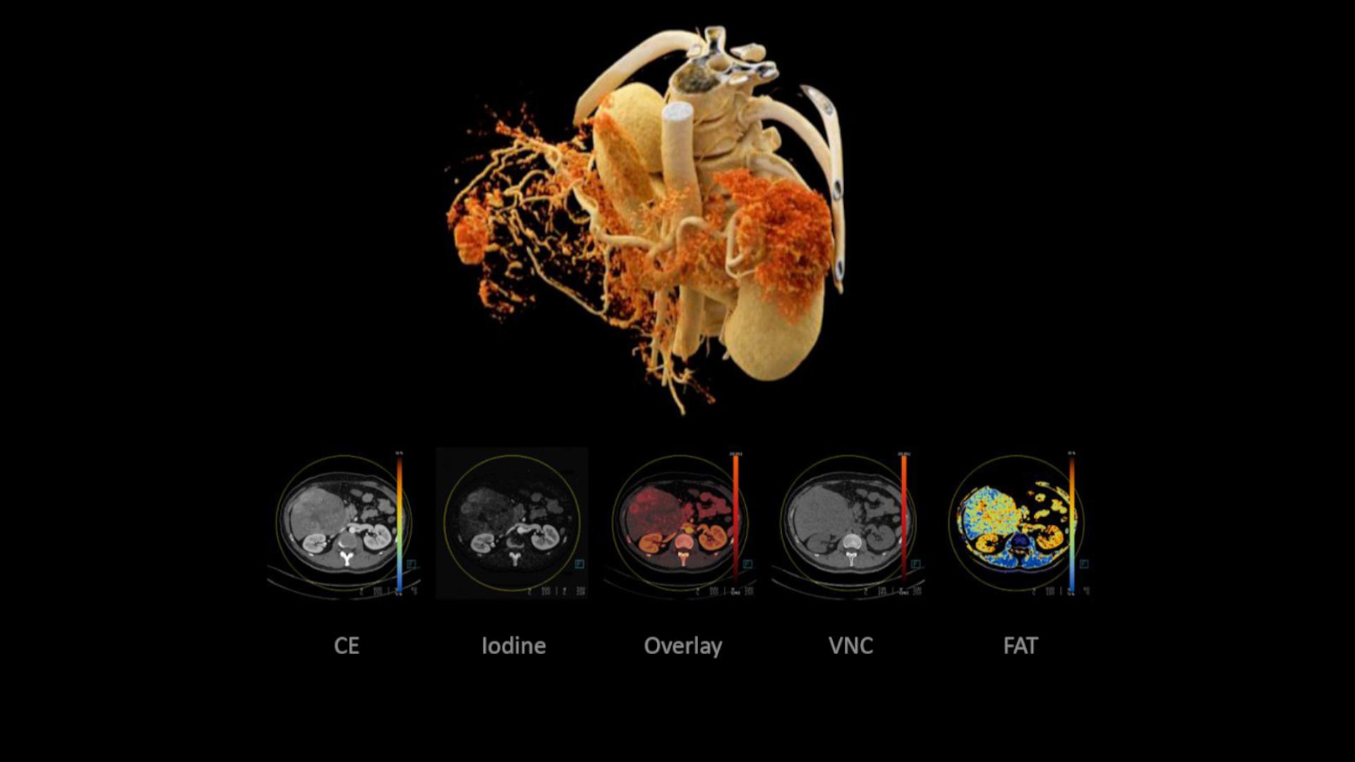 Dual Source CT – Siemens Healthineers Deutschland