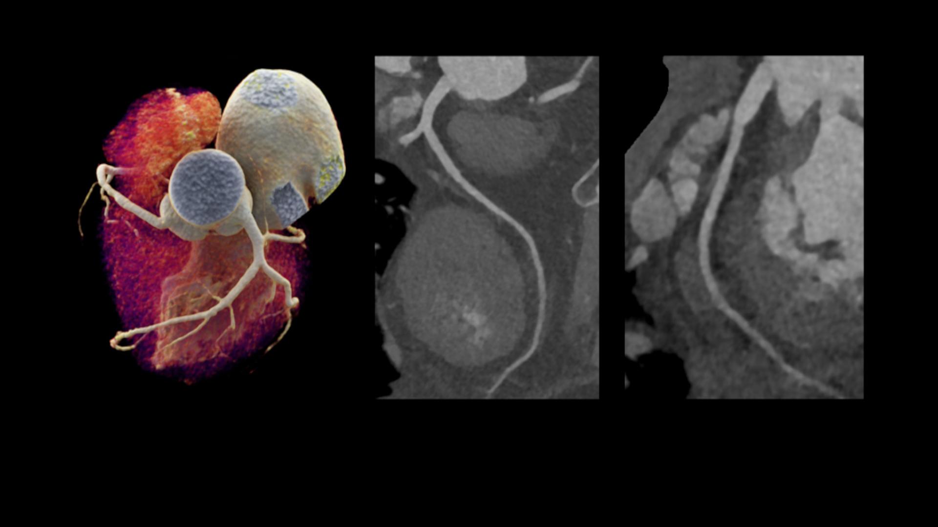 Dual Source CT – Siemens Healthineers Deutschland