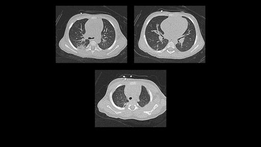 Dual Source CT - Siemens Healthineers USA
