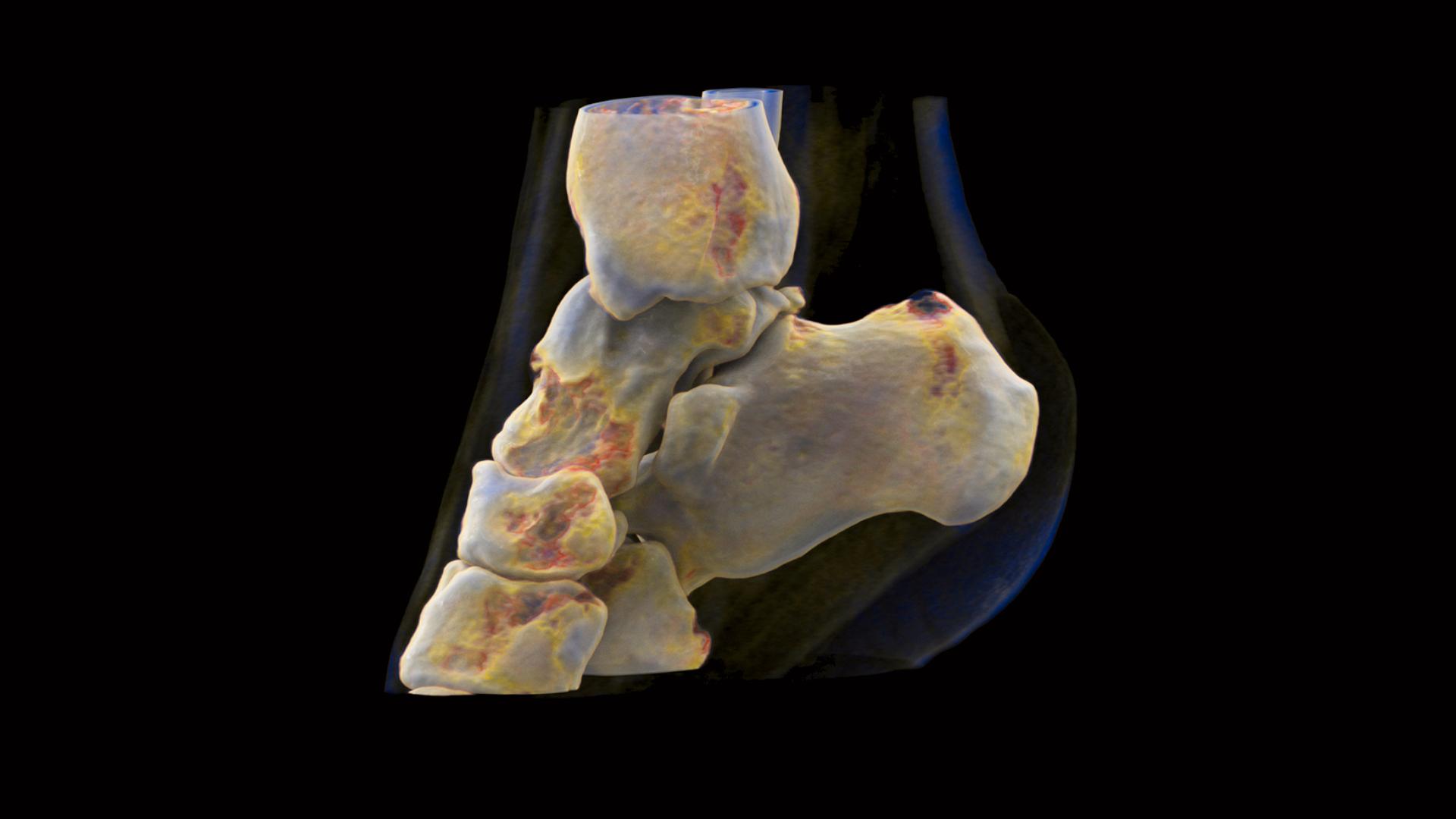 Dual Source CT - Siemens Healthineers Canada