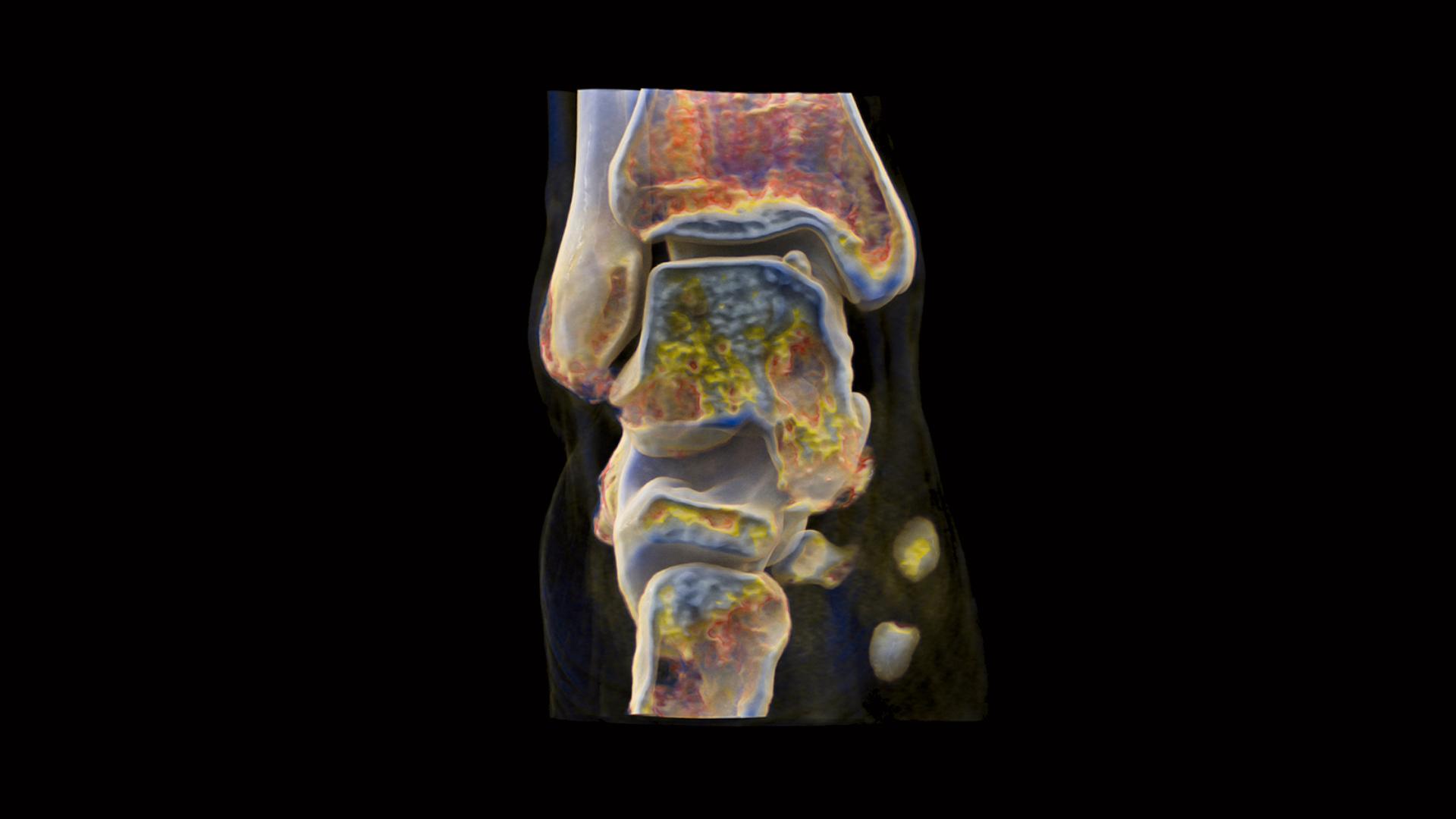 Dual Source CT - Siemens Healthineers Canada