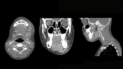 SOMATOM go.All with myExam Companion - Siemens Healthineers India
