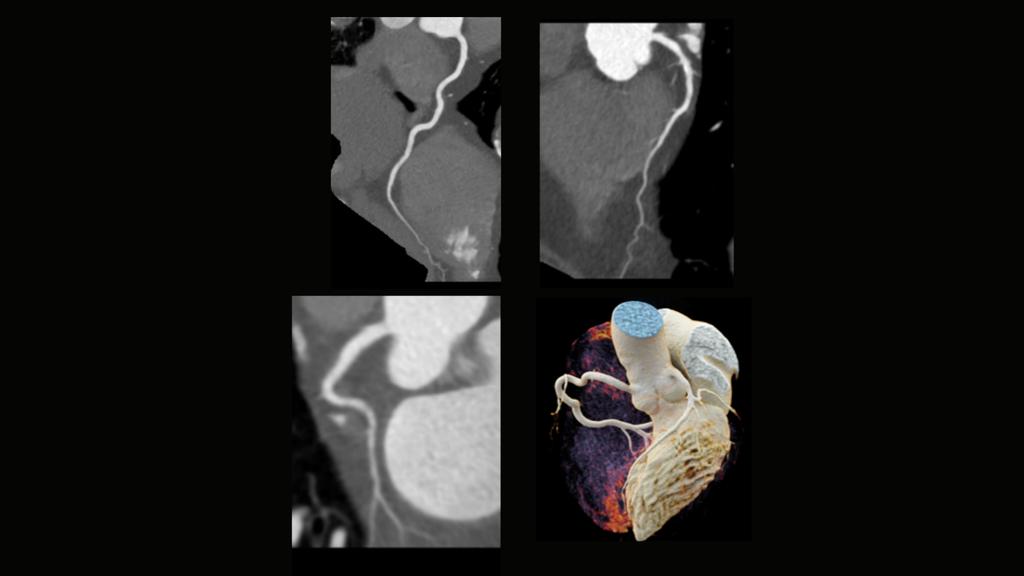 SOMATOM go.All with myExam Companion - Siemens Healthineers India