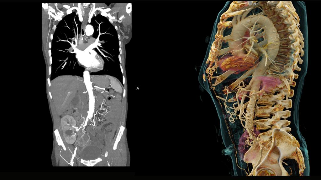 SOMATOM go.All with myExam Companion - Siemens Healthineers India