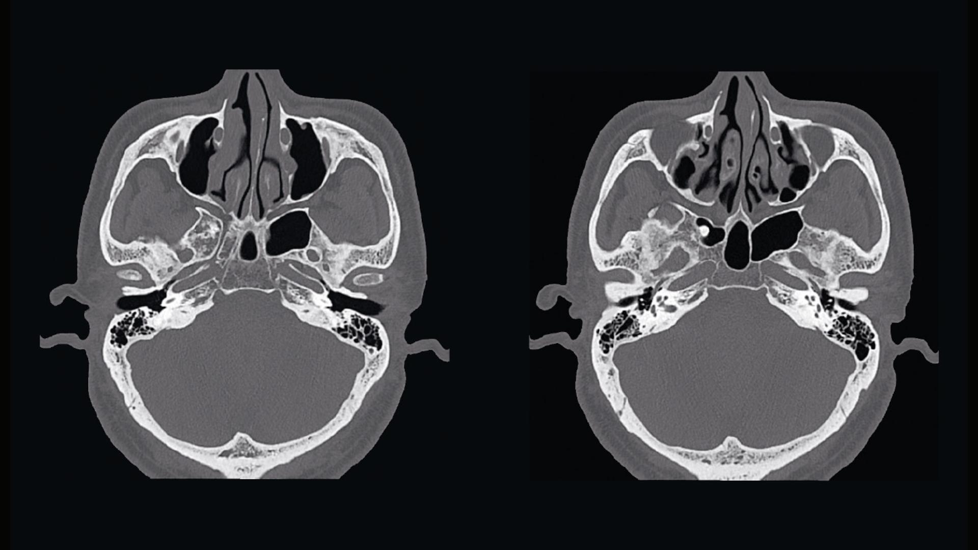 SOMATOM go.Now with myExam Companion - Siemens Healthineers India