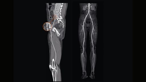 SOMATOM go.Now with myExam Companion - Siemens Healthineers India