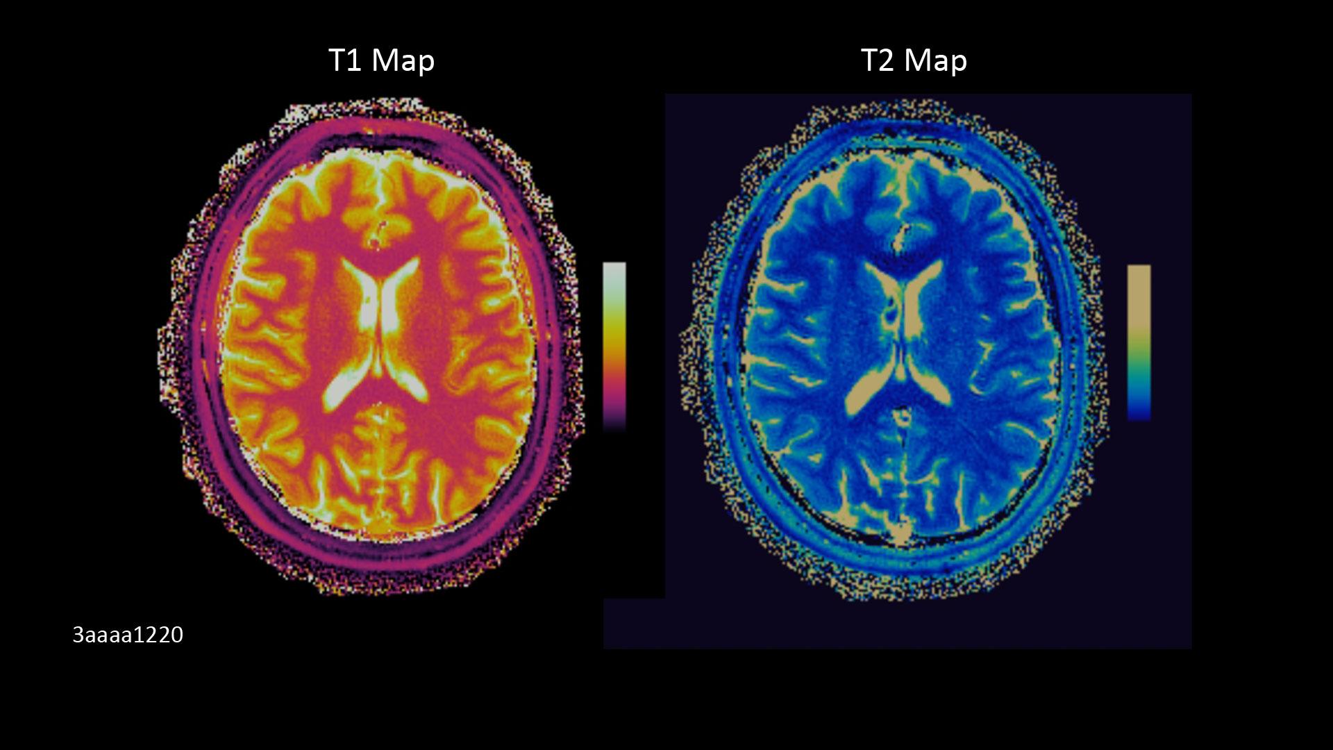 MAGNETOM Vida Pro Edition - Elevated MRI Experience. - Siemens ...