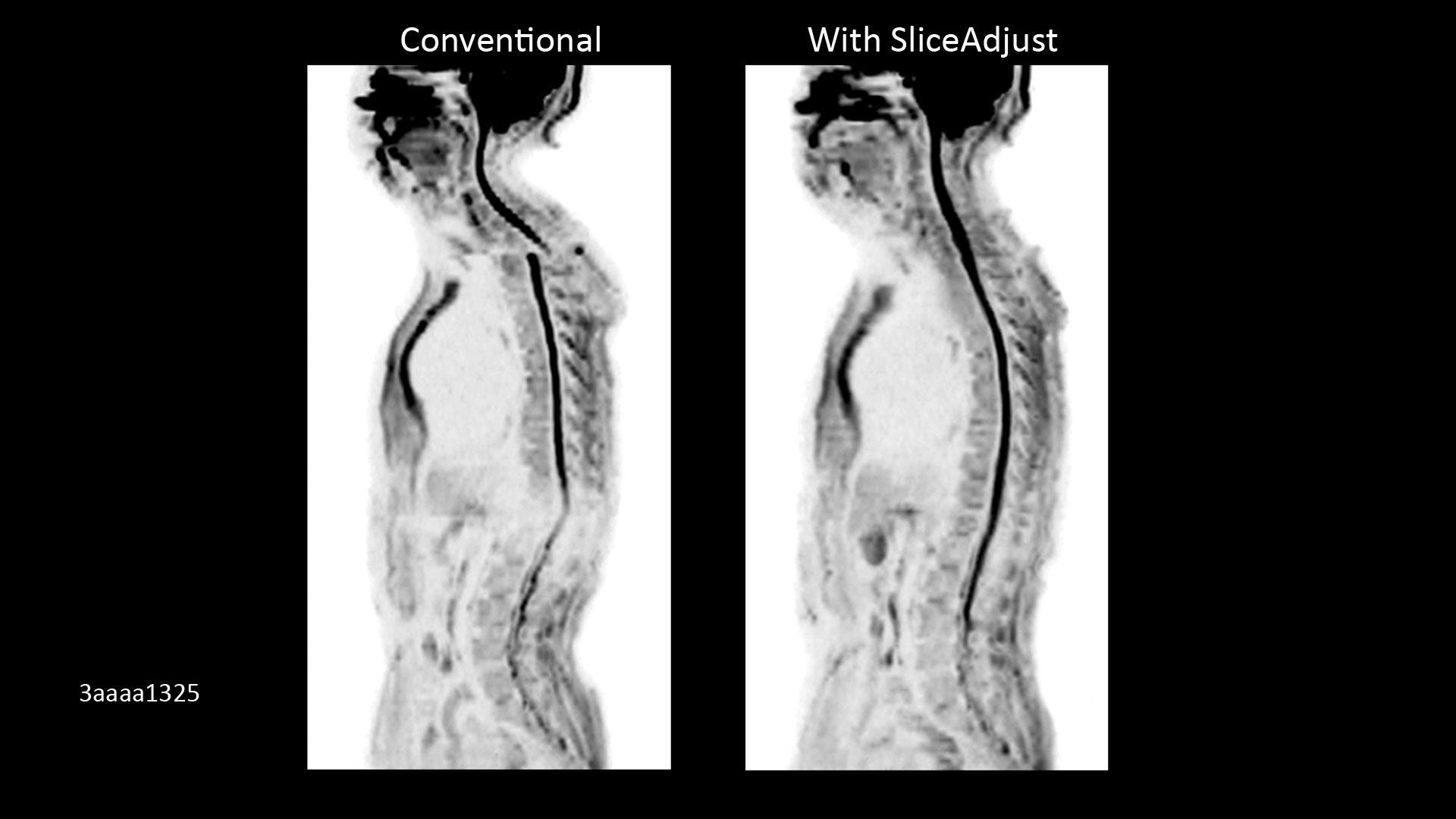 MAGNETOM Vida - Leading the field - Siemens Healthineers