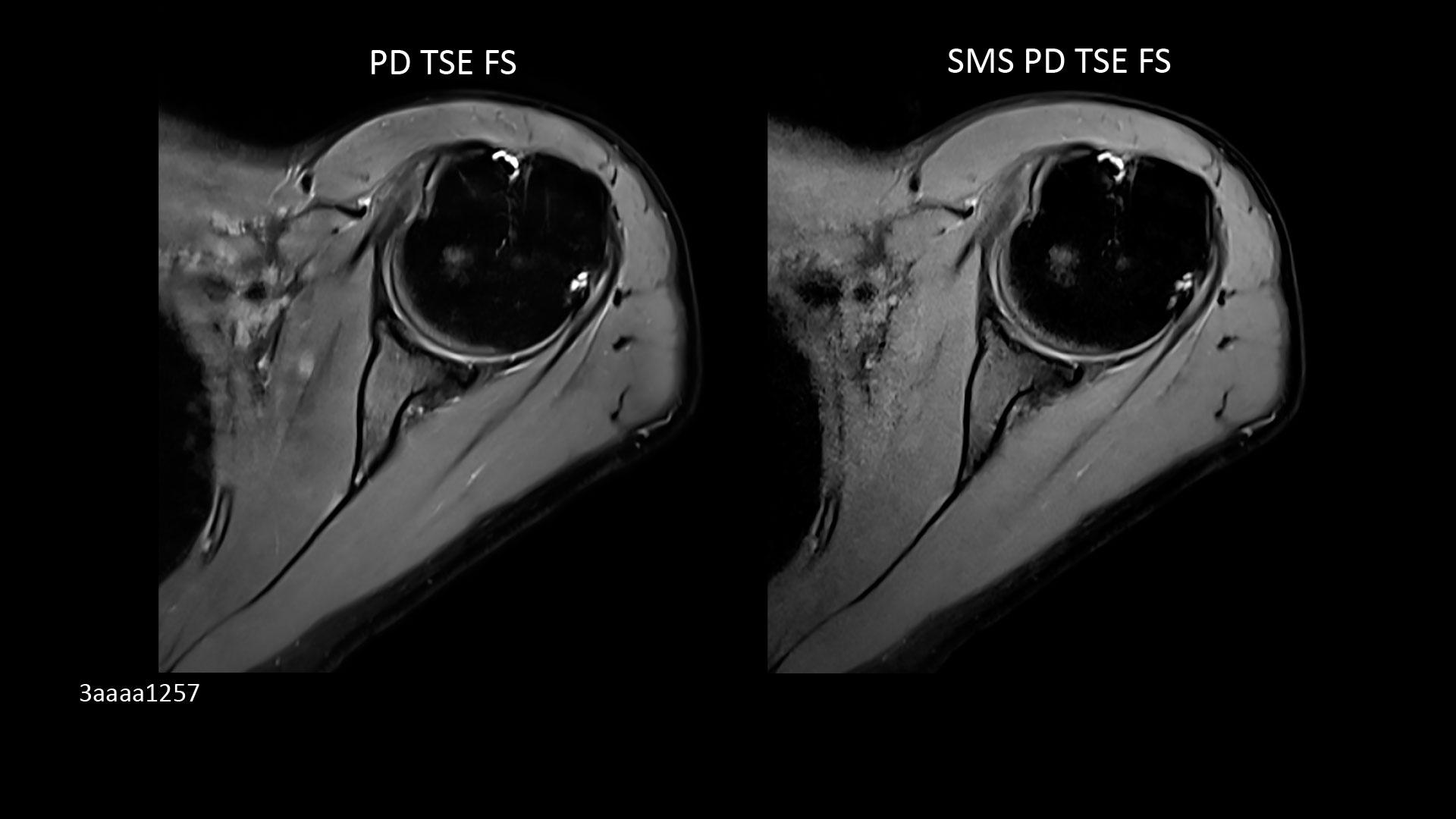 MAGNETOM Vida - Leading the field - Siemens Healthineers