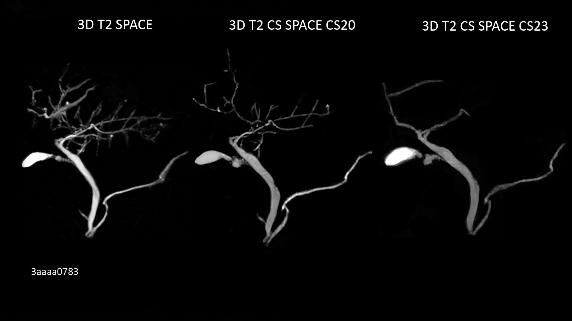 MAGNETOM Vida - Leading the field - Siemens Healthineers