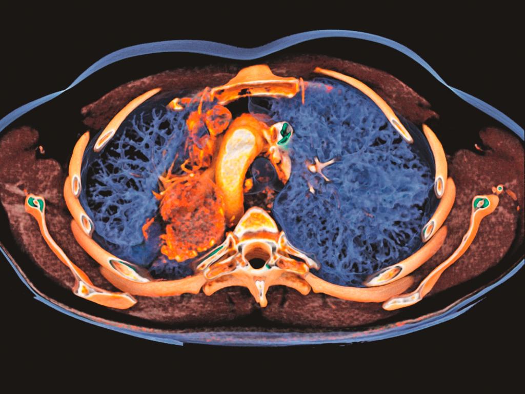 Computed Tomography - Siemens Healthineers