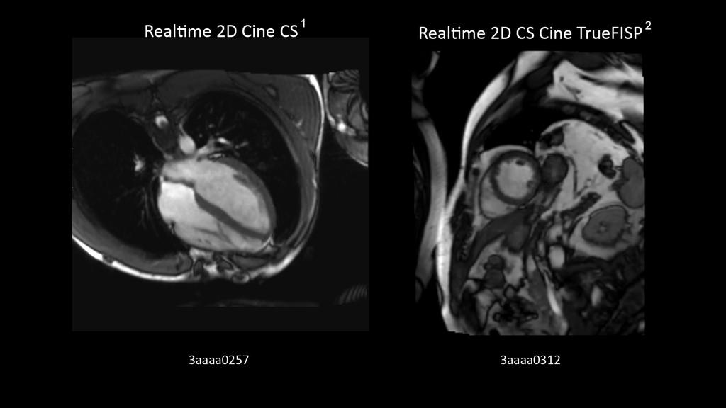 MAGNETOM Vida - Leading the field - Siemens Healthineers