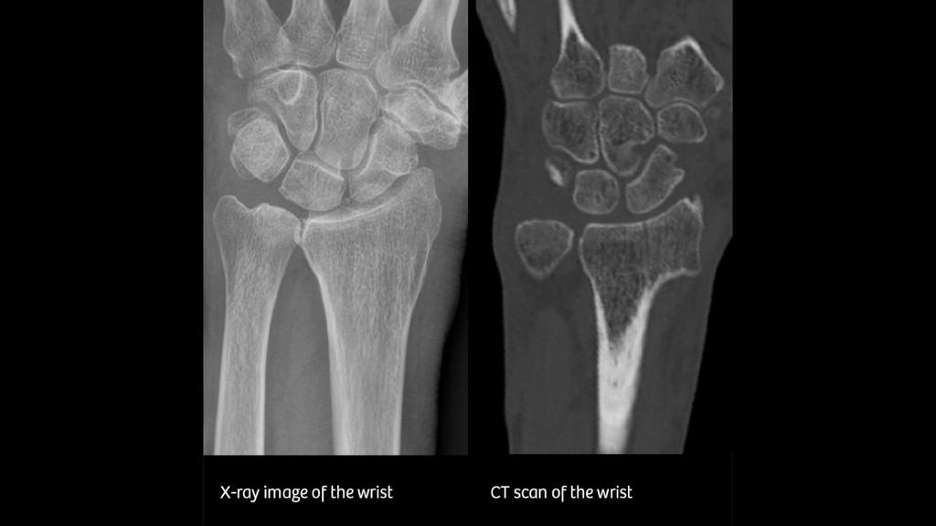 Twin Robotic X-ray scanner – Multitom Rax - Siemens Healthineers Sverige