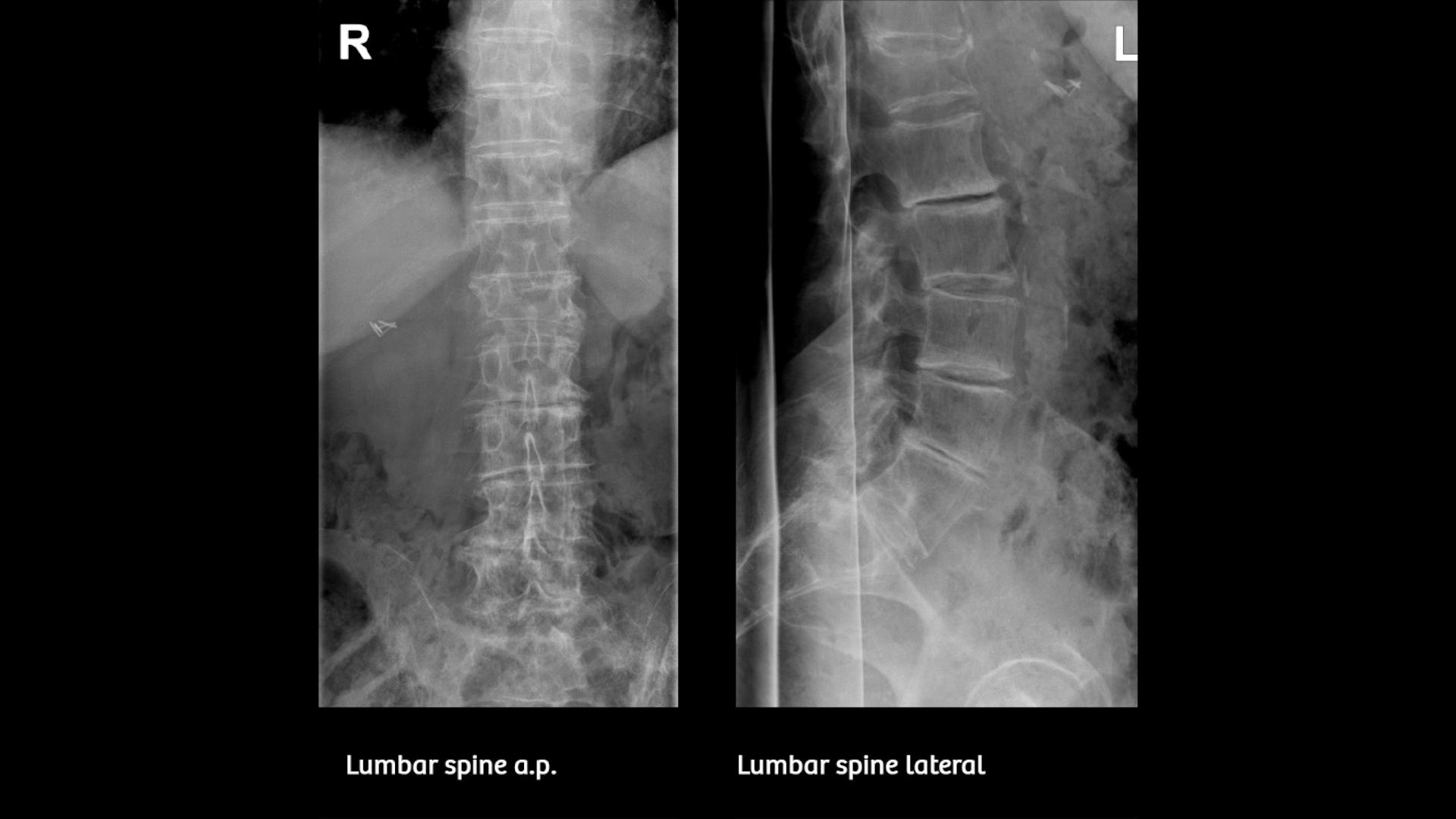 Twin Robotic X-ray scanner – Multitom Rax - Siemens Healthineers Sverige