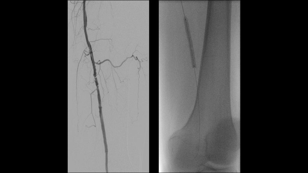 Twin Robotic X-ray scanner – Multitom Rax - Siemens Healthineers Sverige