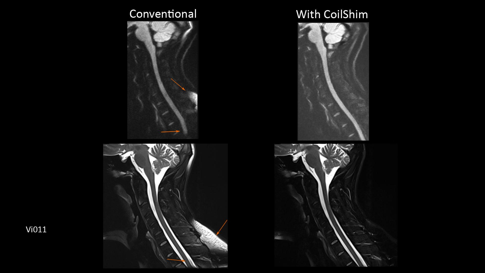 MAGNETOM Vida - Siemens Healthineers USA