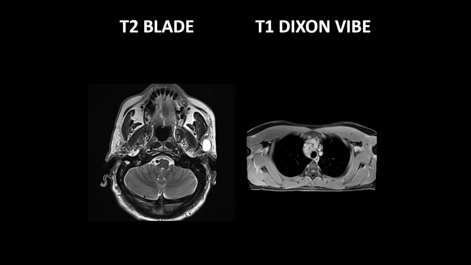 RT Pro Edition for MAGNETOM Sola and Vida - Siemens Healthineers