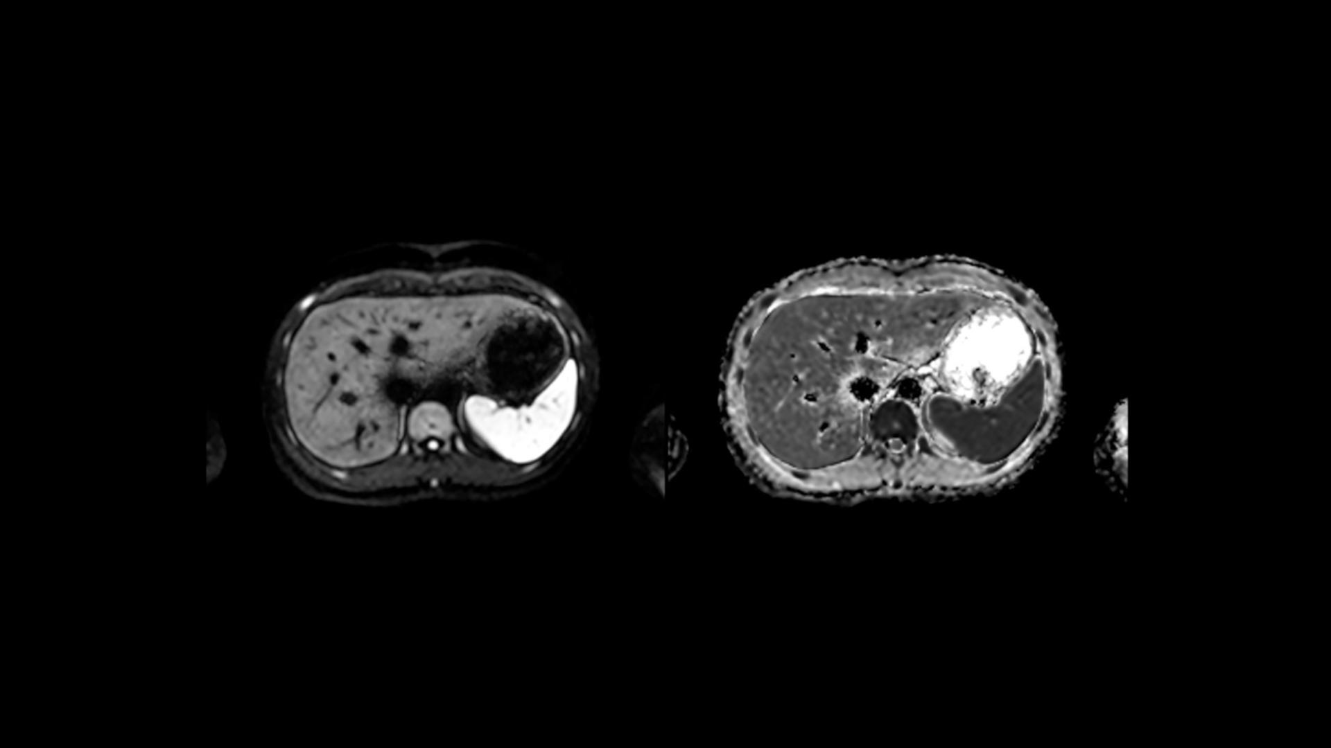 MAGNETOM Altea – Siemens Healthineers Deutschland