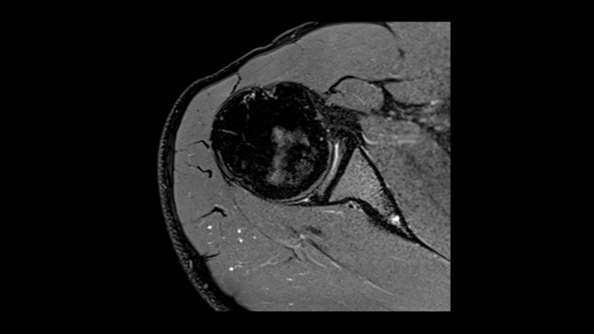 MAGNETOM Altea - Siemens Healthineers