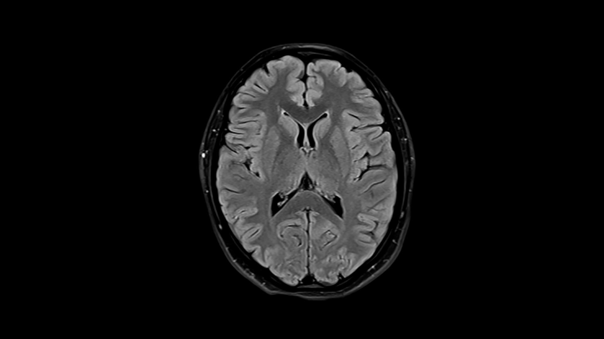 MAGNETOM Altea - Siemens Healthineers