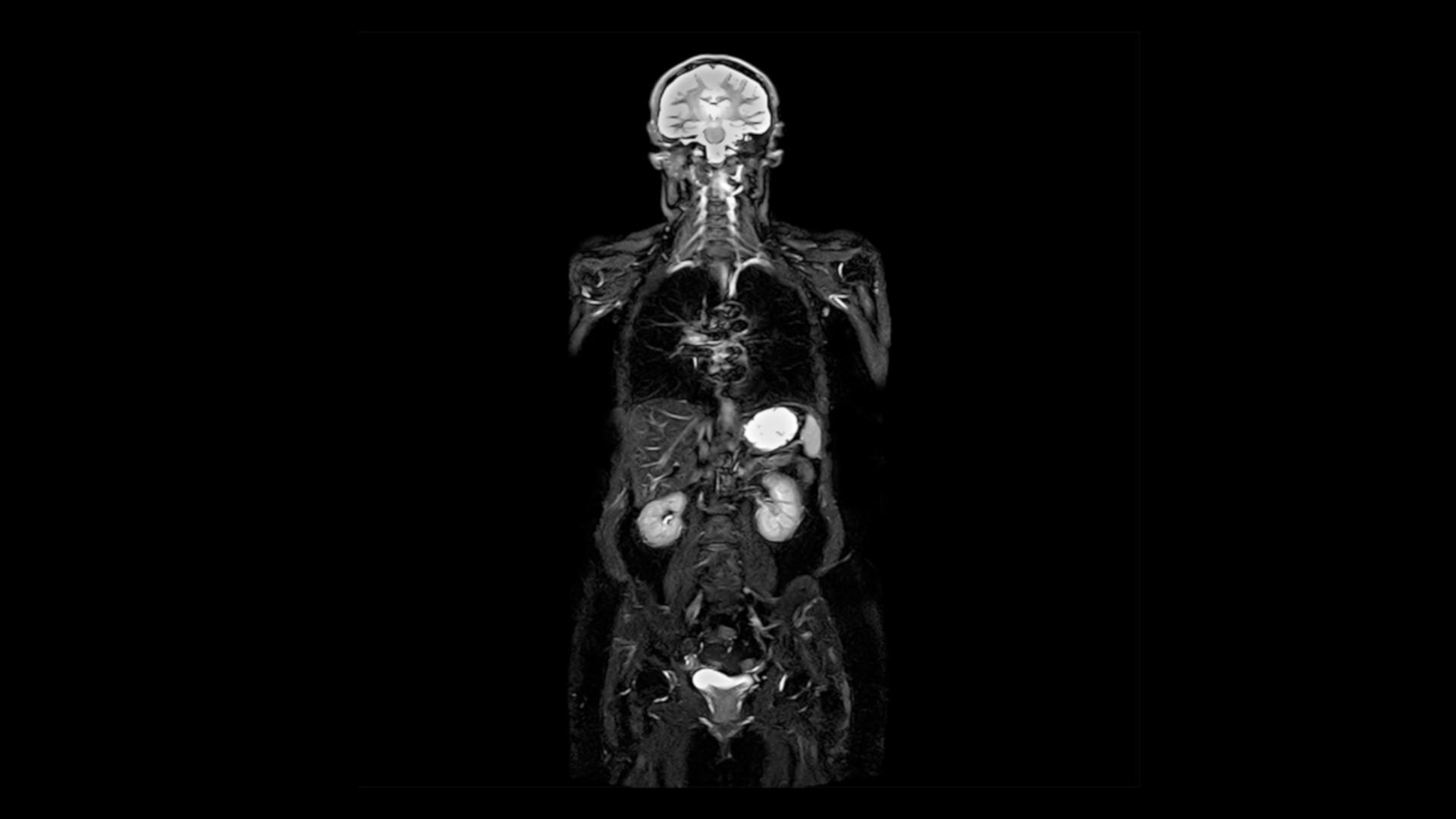 MAGNETOM Altea - Siemens Healthineers