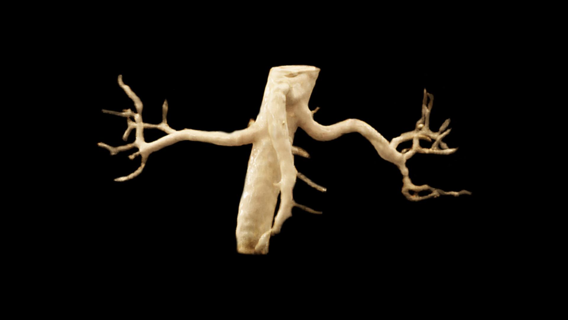 MAGNETOM Amira - A BioMatrix System - Siemens Healthineers