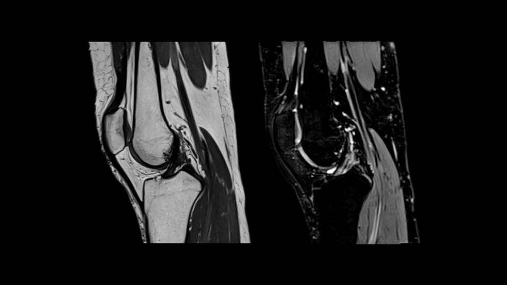 MAGNETOM Amira - A BioMatrix System - Siemens Healthineers