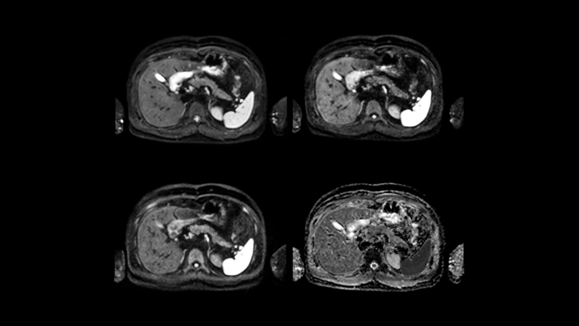 MAGNETOM Amira - A BioMatrix System - Siemens Healthineers