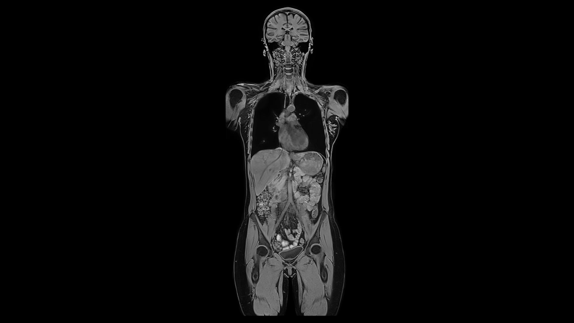 MAGNETOM Amira - A BioMatrix System - Siemens Healthineers India
