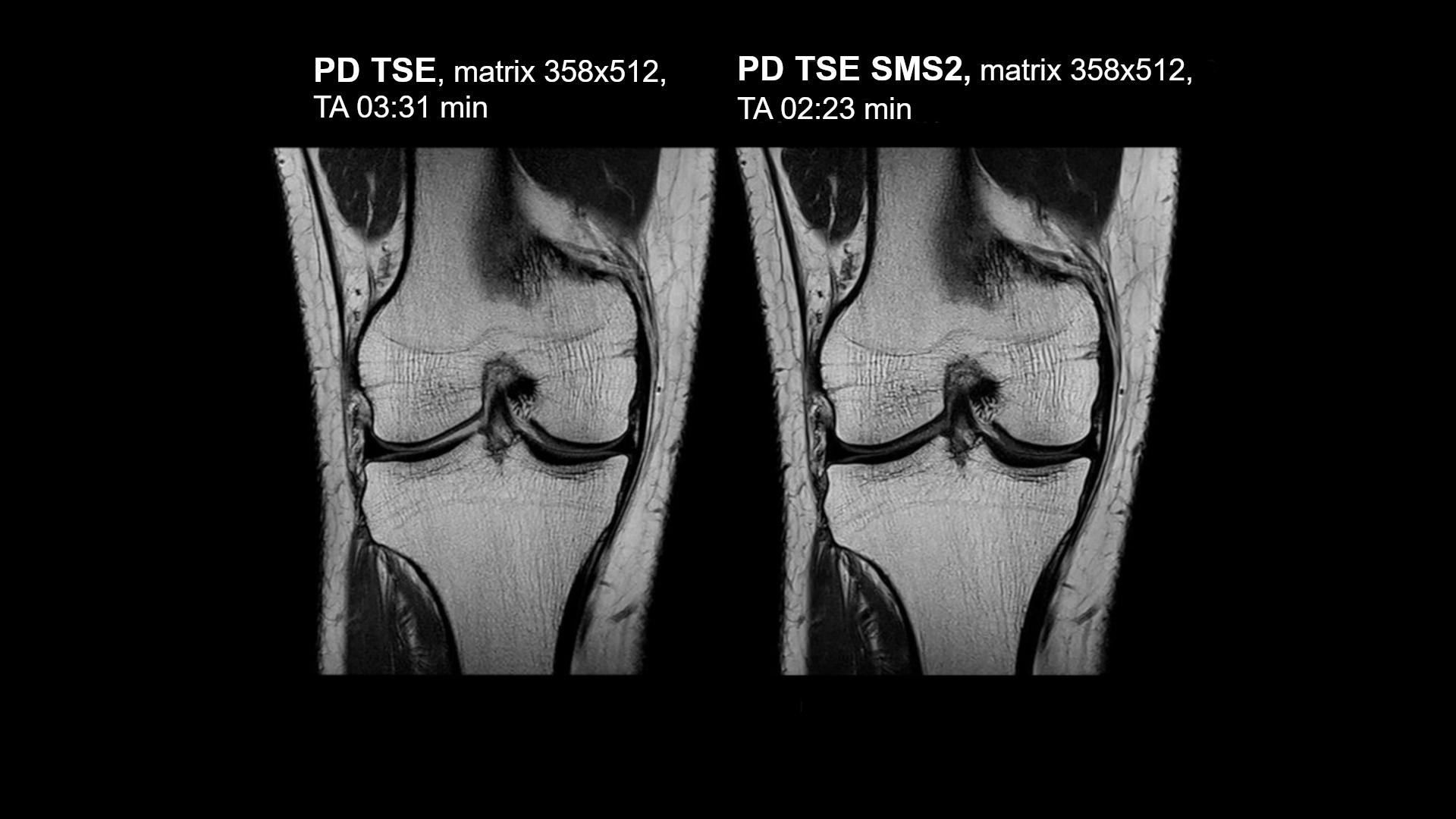 MAGNETOM Amira - A BioMatrix System - Siemens Healthineers