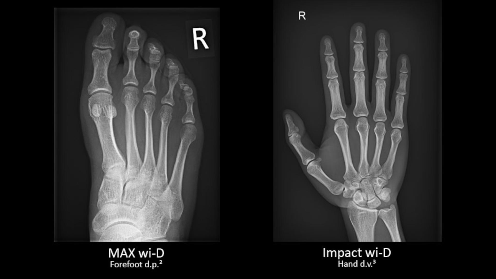 MULTIX Impact - Siemens Healthineers Vietnam