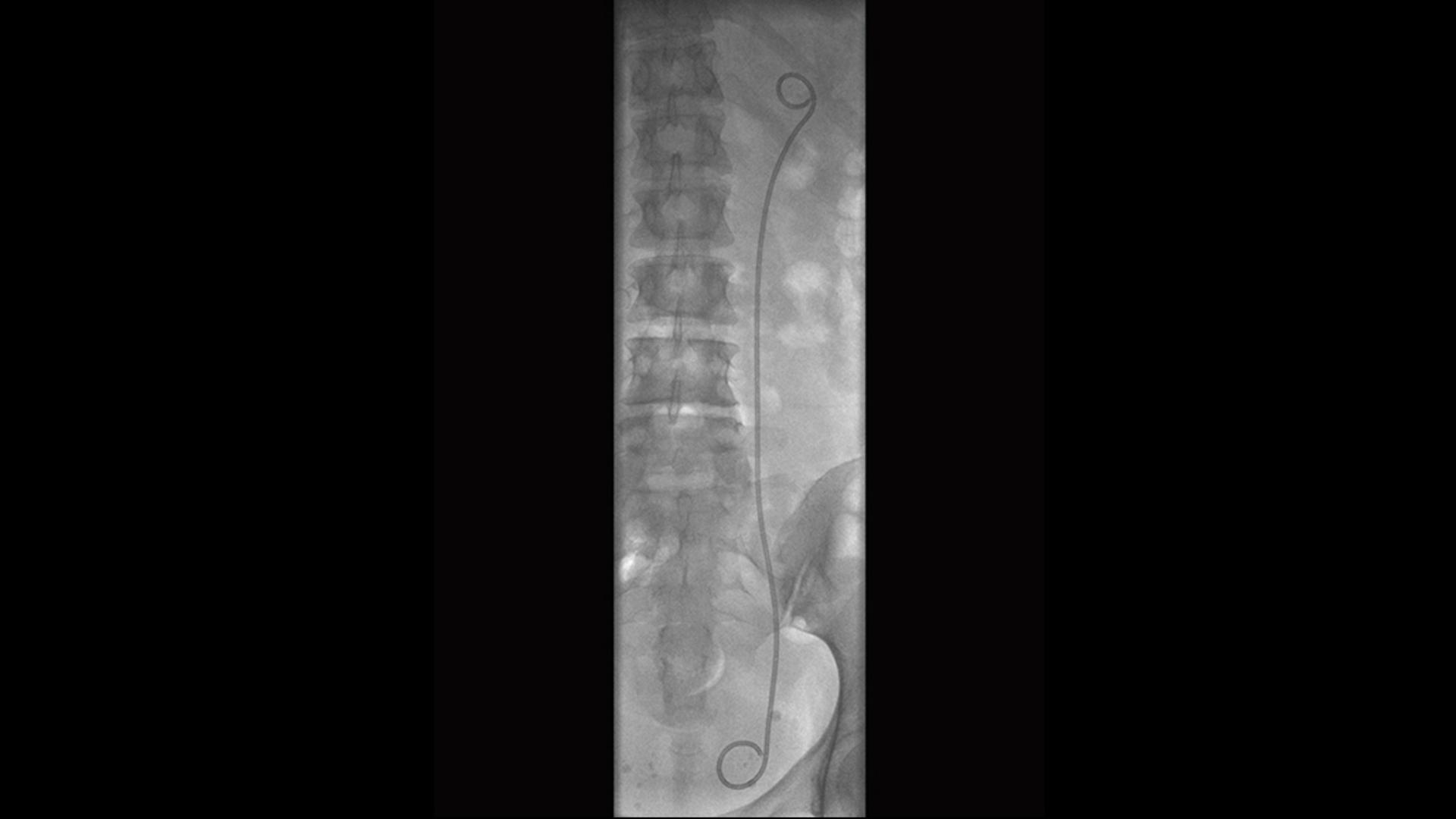 Urology device Uroskop Omnia Max - Siemens Healthineers