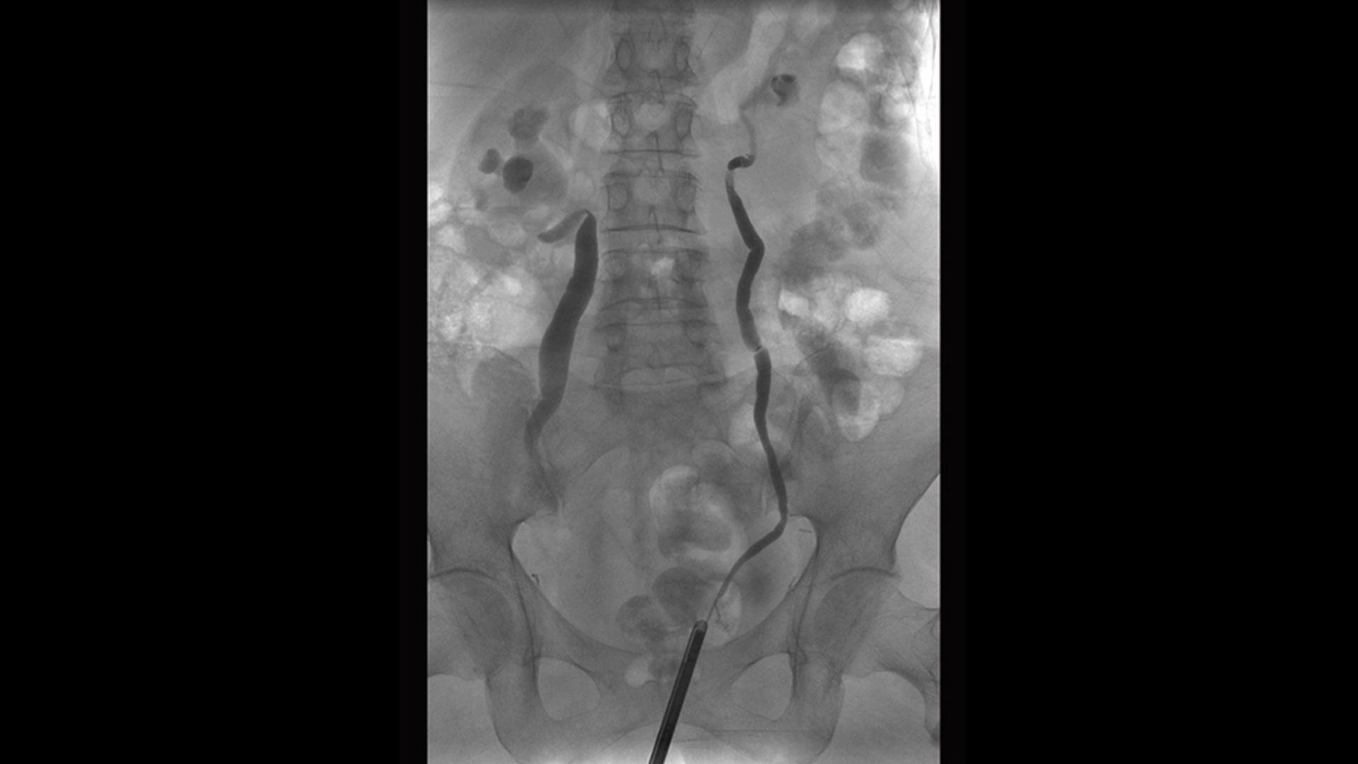 Urology device Uroskop Omnia Max - Siemens Healthineers USA
