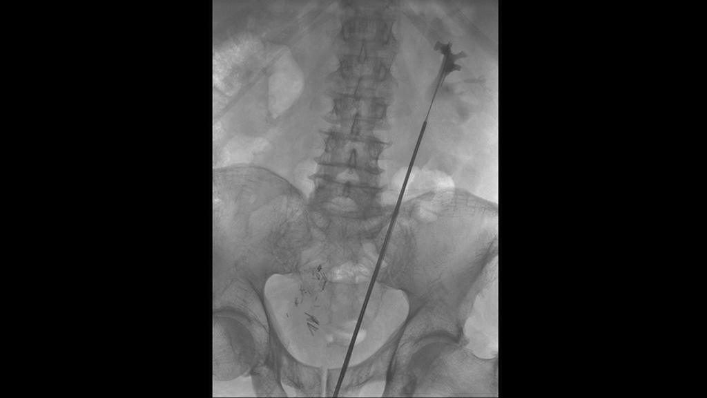 Urology device Uroskop Omnia Max - Siemens Healthineers USA