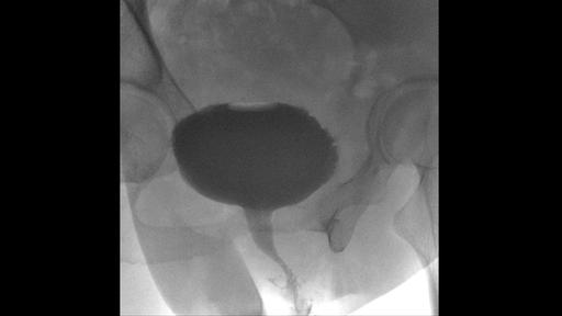Urology device Uroskop Omnia Max - Siemens Healthineers
