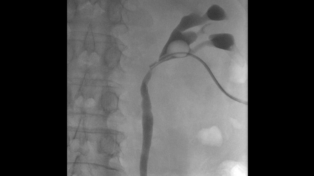 Urologiesystem Uroskop Omnia Max – Siemens Healthineers Deutschland