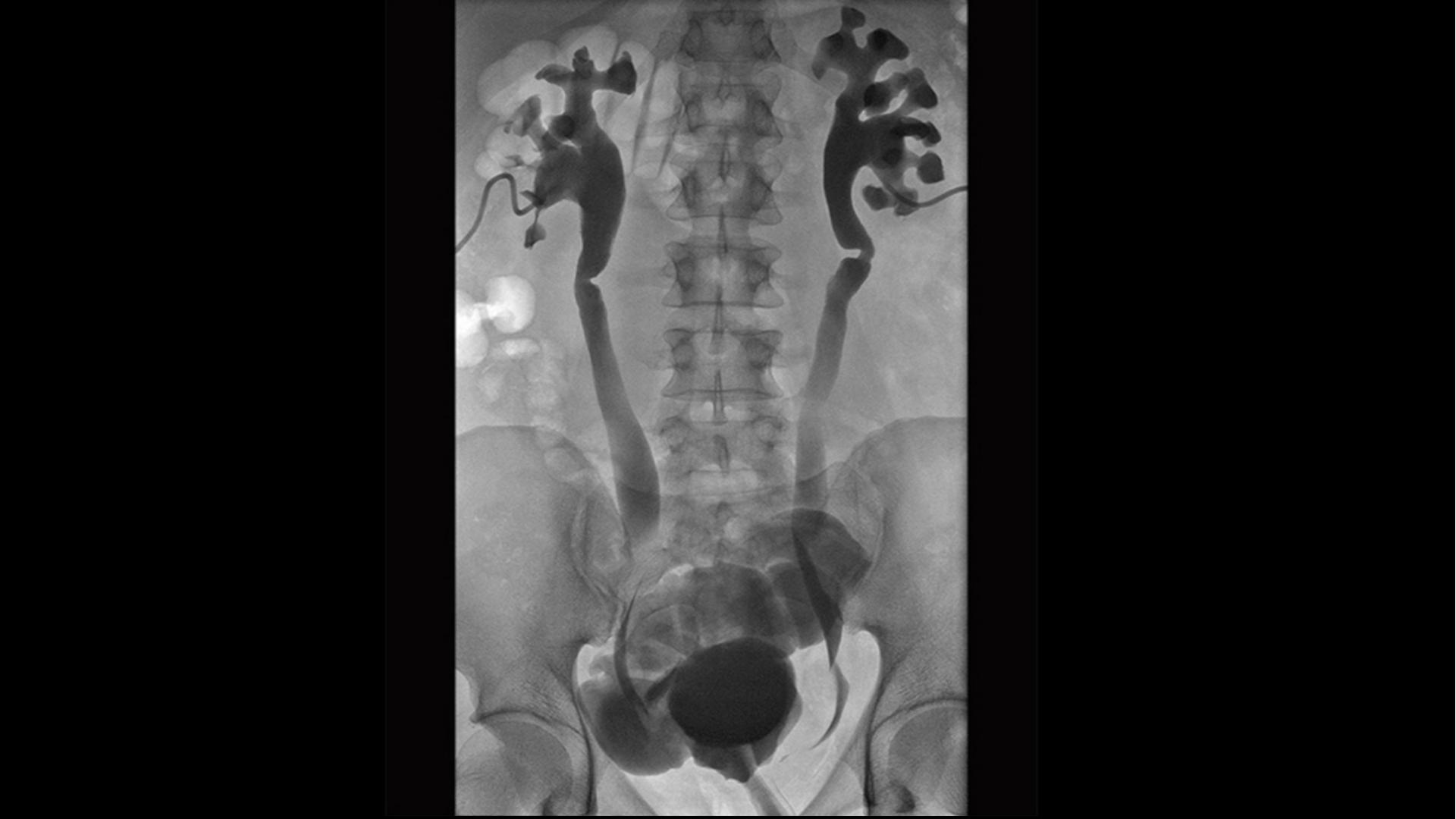 Urology device Uroskop Omnia Max - Siemens Healthineers USA
