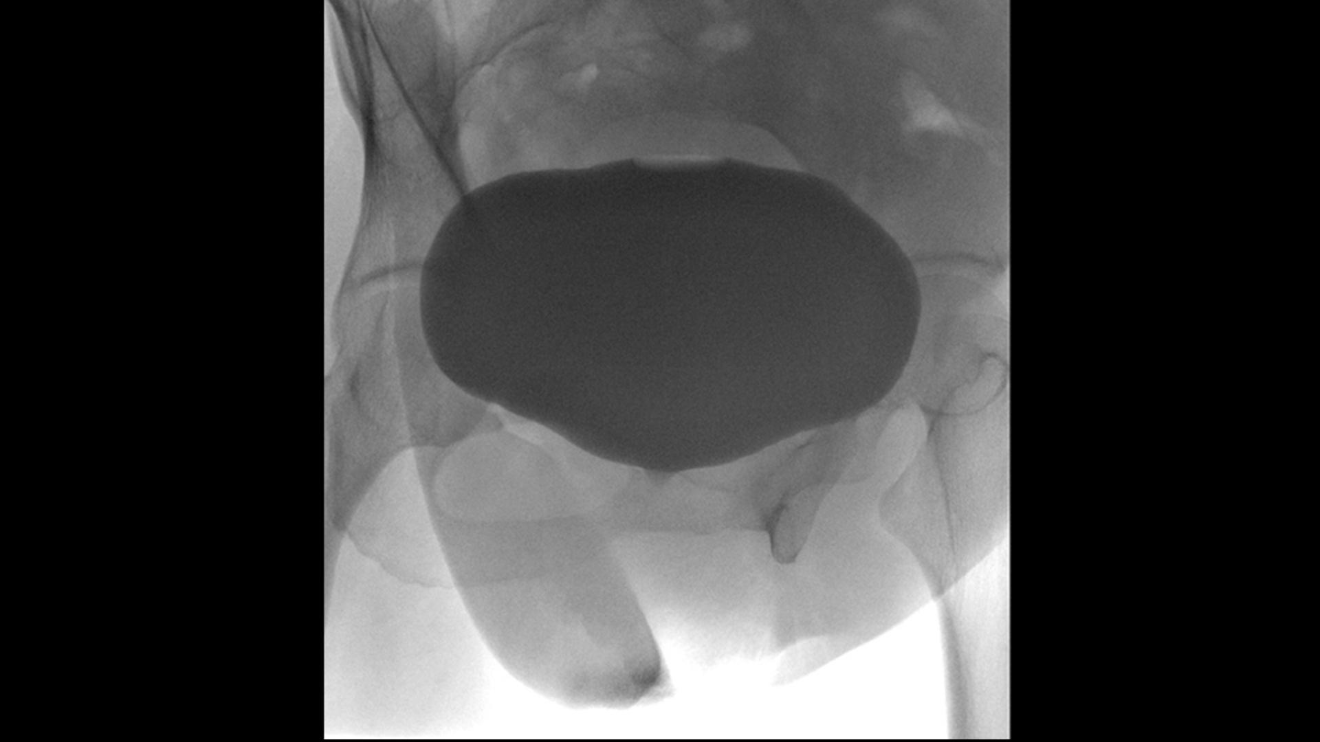 Urology device Uroskop Omnia Max - Siemens Healthineers USA