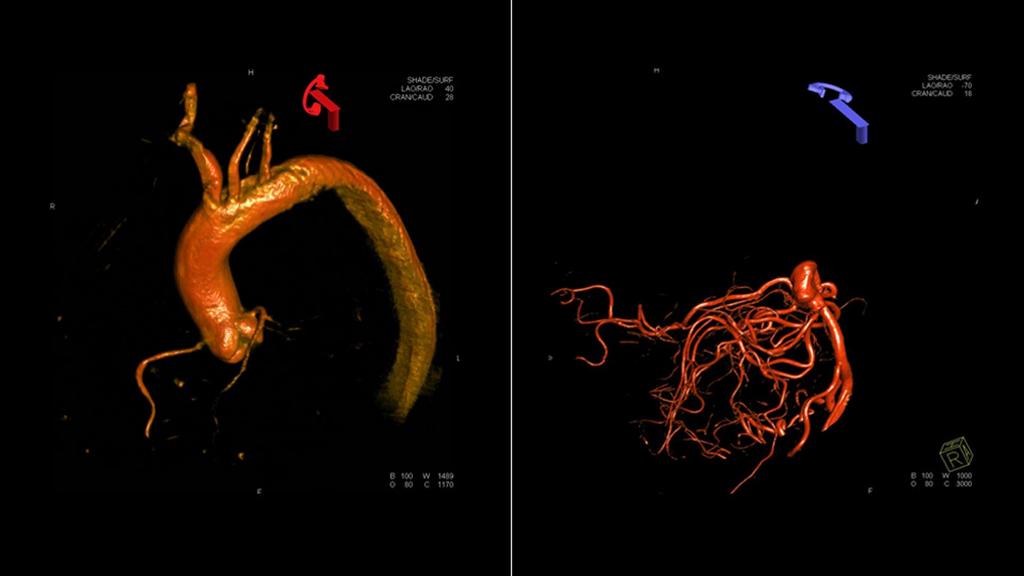 Artis one - Siemens Healthineers USA