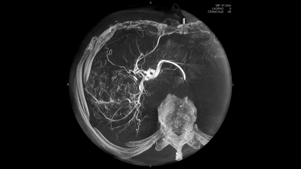 syngo DynaCT - Siemens Healthineers USA