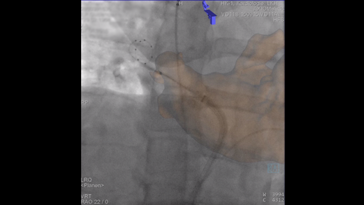 Artis Q.zen - Siemens Healthineers