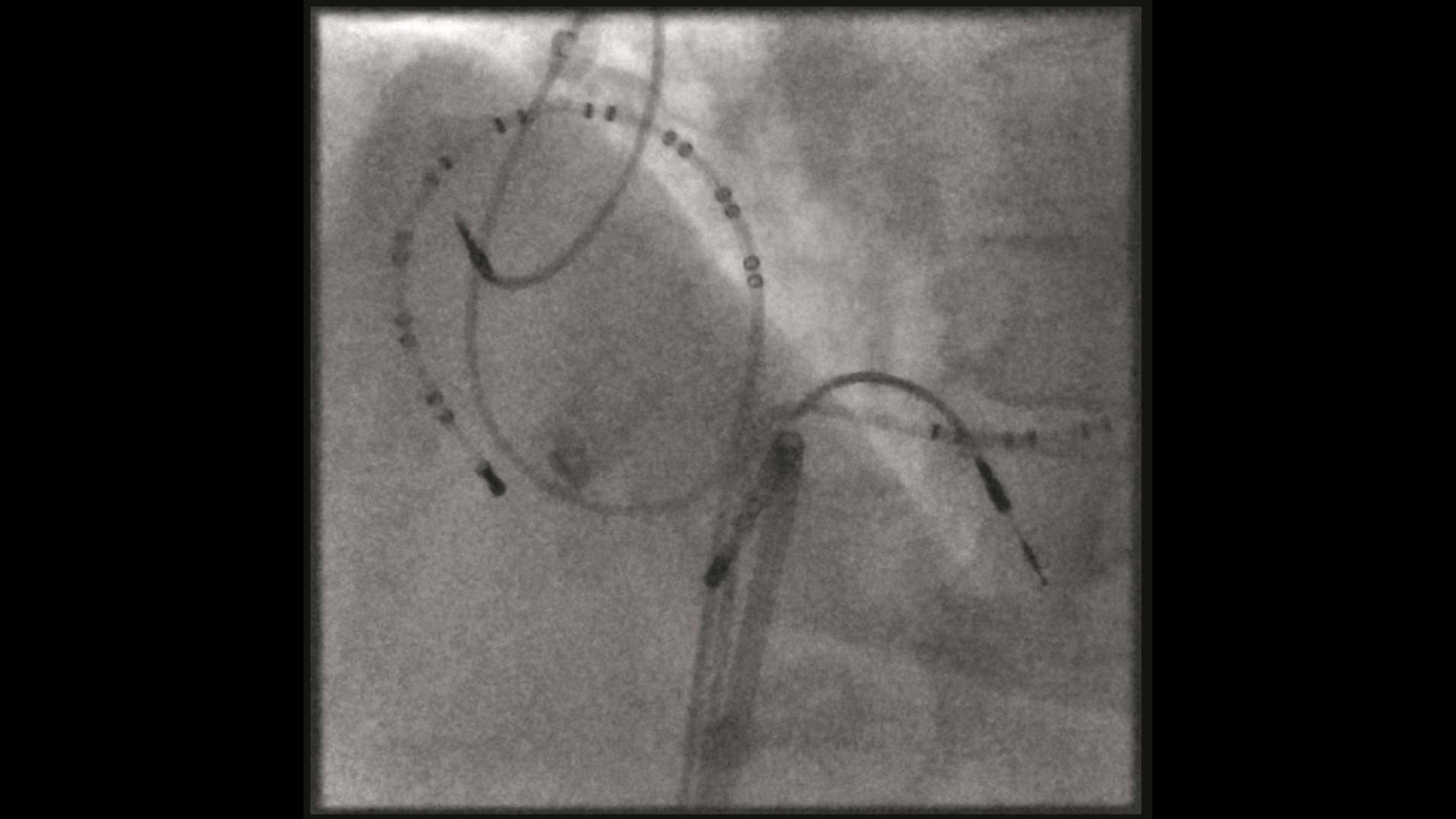 Artis Q.zen - Siemens Healthineers