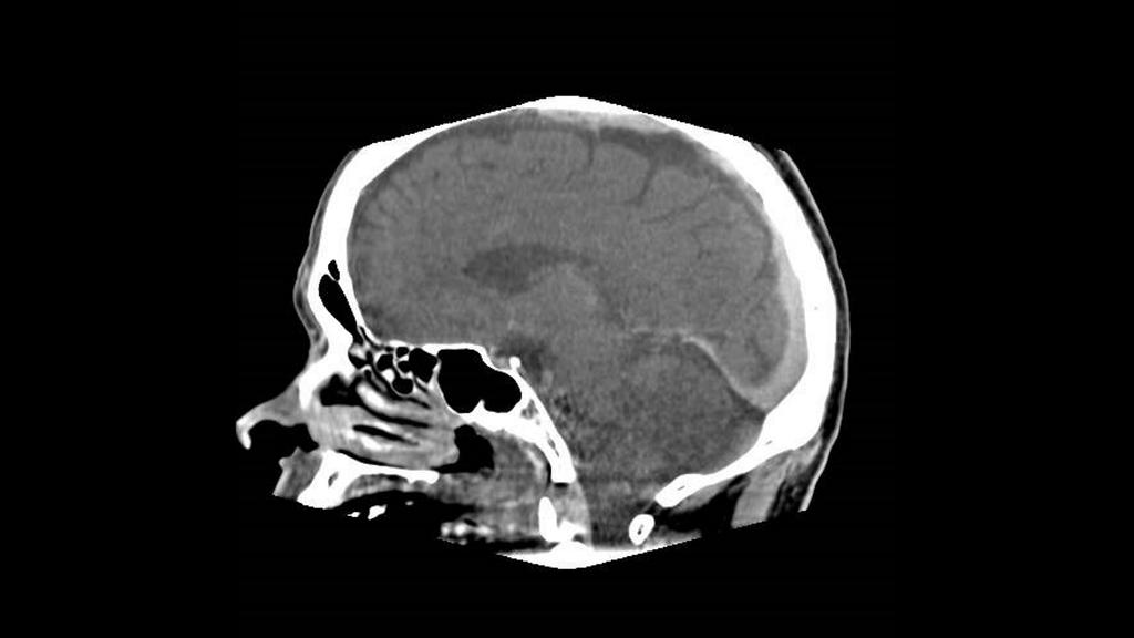 ARTIS icono - Siemens Healthineers Schweiz